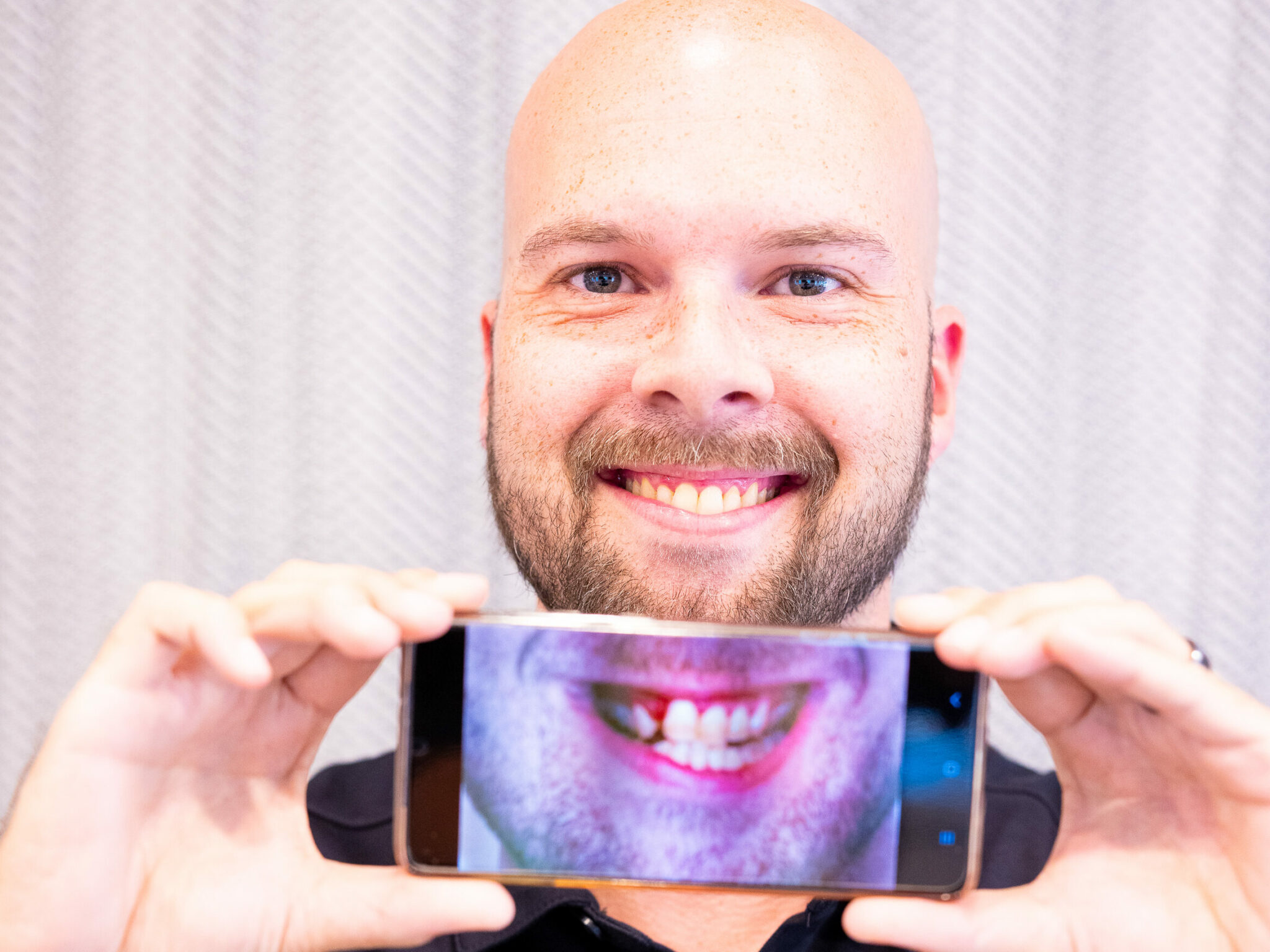 Does Bite Classification Matter for My Braces Treatment?